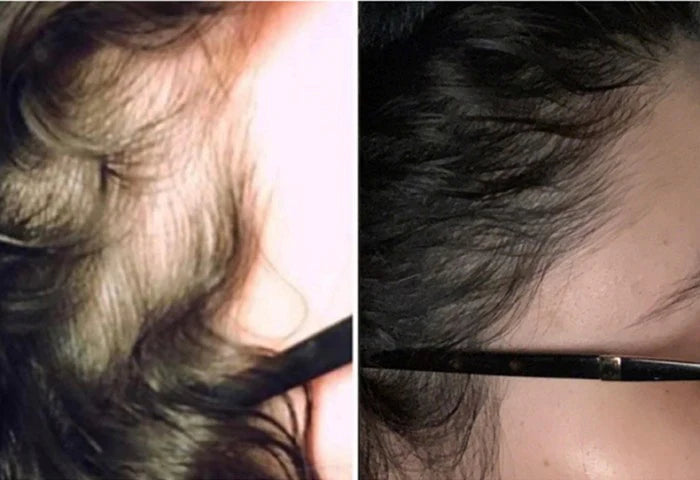 5 Jaw Dropping Hair Growth Transformations You Must See – R R O